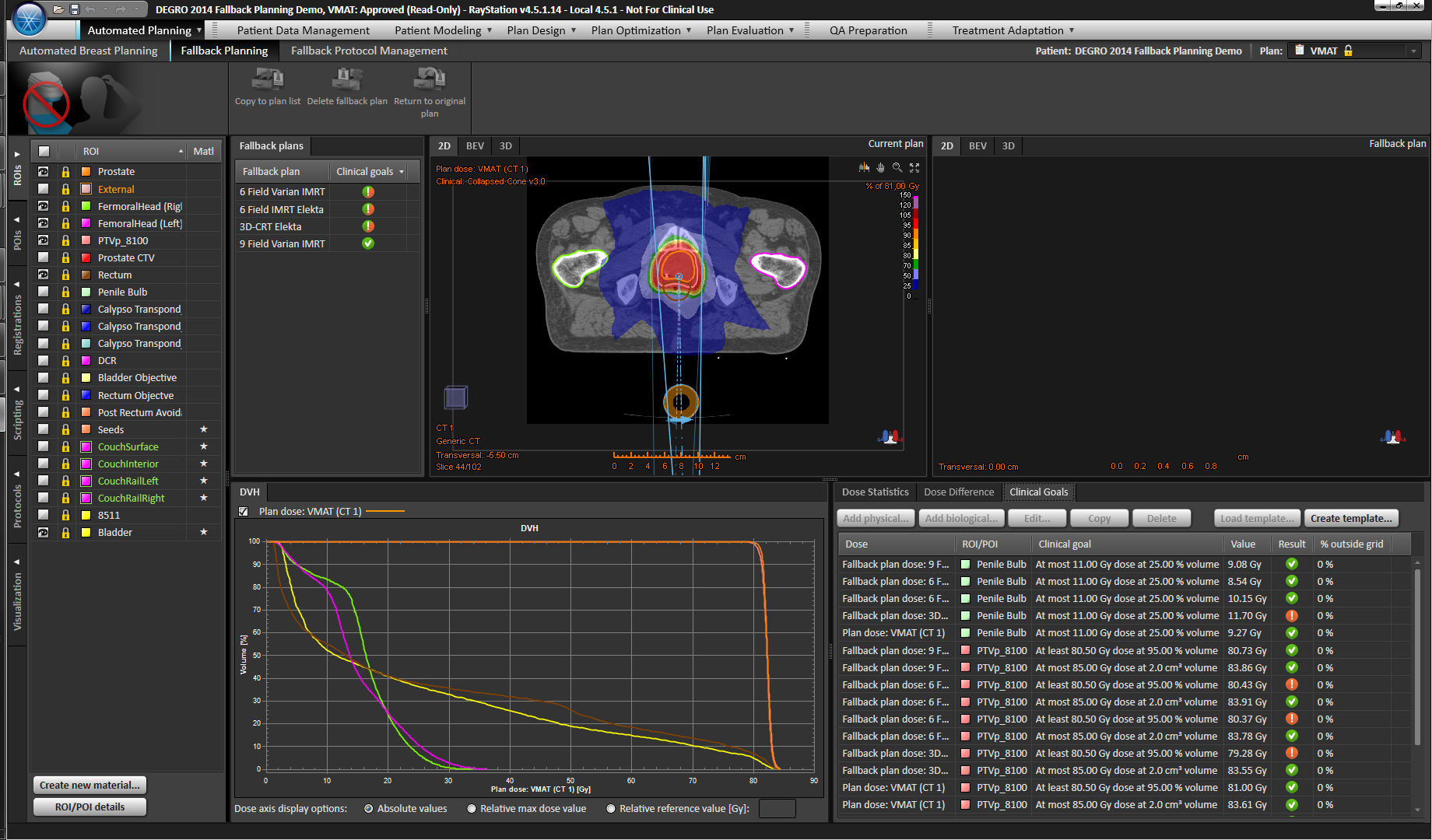 Automated Treatment Planning | RaySearch Laboratories