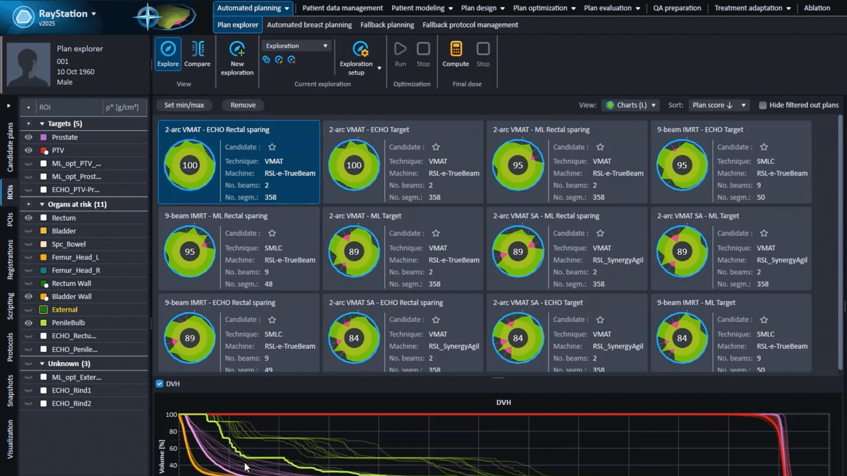 RayStation v2025 | RaySearch Laboratories