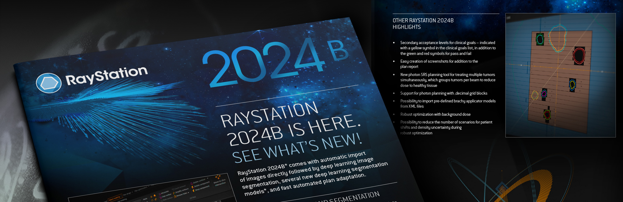 Treatment Planning System - RayStation | RaySearch Laboratories