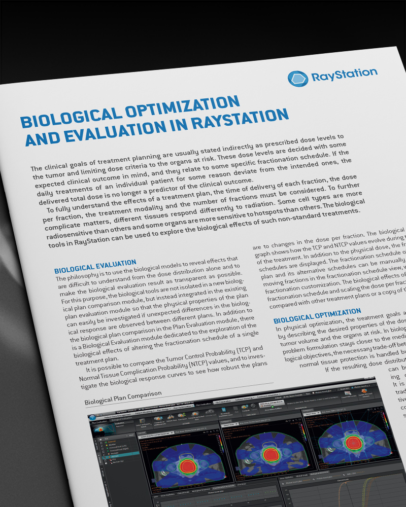 Patient Contouring and Plan Evaluation in RayStation | RaySearch ...