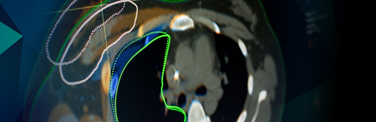 Treatment Planning System - RayStation | RaySearch Laboratories
