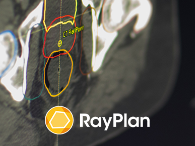 Image bank | RaySearch Laboratories