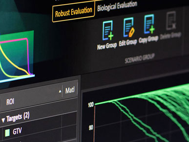 Treatment Planning System - RayStation | RaySearch Laboratories